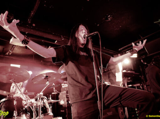 Embryonic Autopsy | Live Photos | Lollipop Magazine